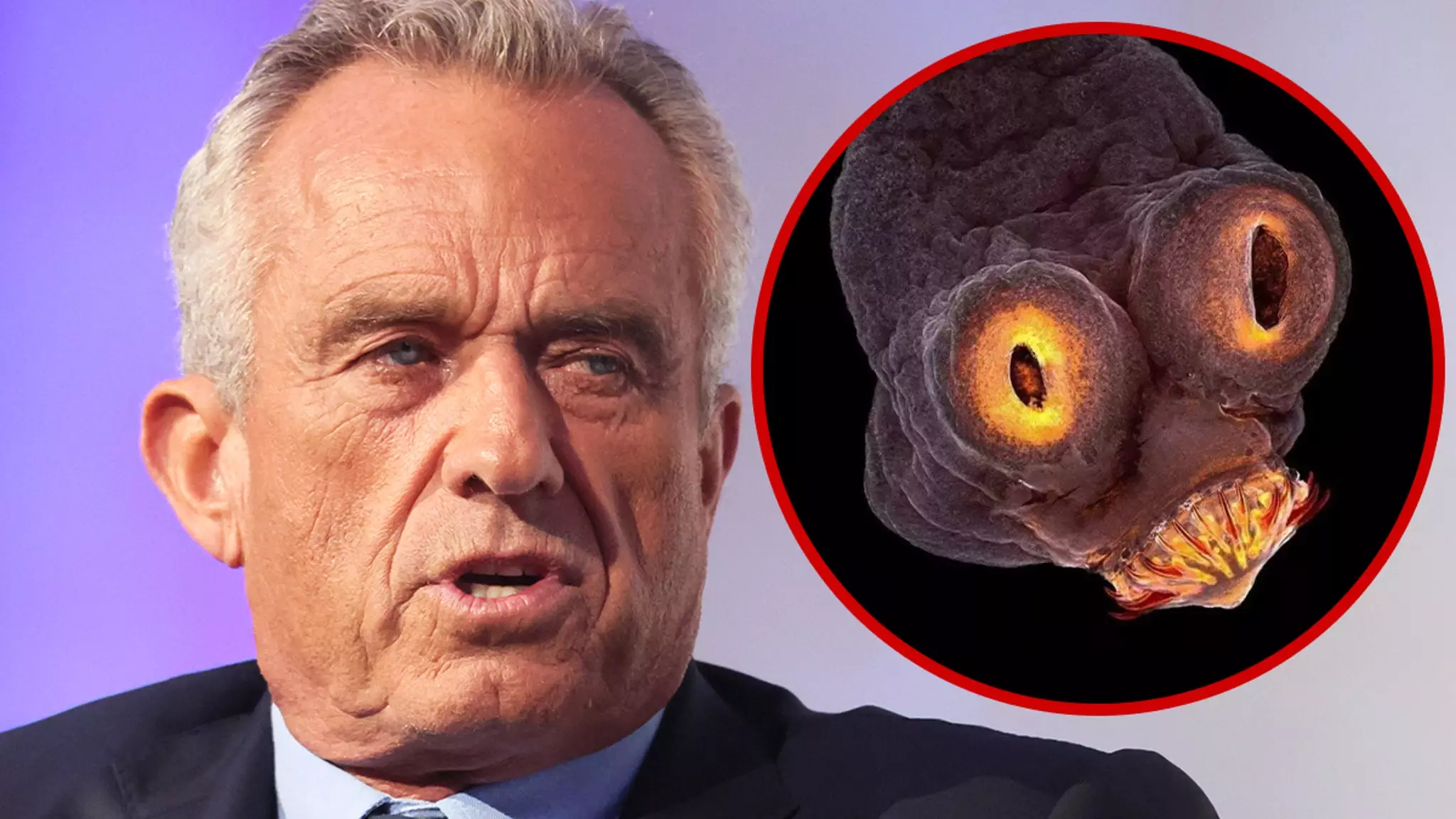 Robert F. Kennedy Jr. and the Brain Parasite Incident: A Critical ...